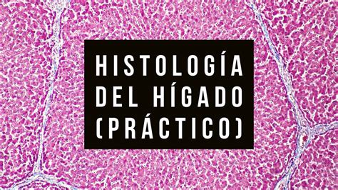 Histologia Hepatica Hepatocitos Histología Hepática Ppt