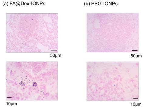Targeted Imaging Of Lung Cancer With Hyperpolarized 129xe Mri Using Surface Modified Iron Oxide