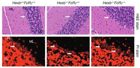 Reduction In The Neurodegeneration Of Purkinje Cells In Download