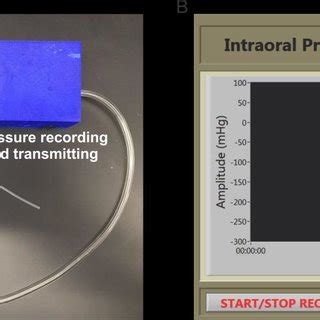 The Prototype Picture Of The BDD A And Software Interface B Download Scientific Diagram