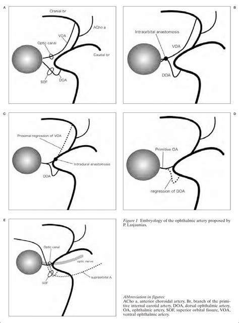 Figure 1 From Embryology Of The Ophthalmic Artery A Revived Concept Semantic Scholar