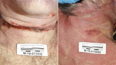 Epstein Suicide Video Is Like The 9 11 Pentagon Cctv Footage Pipr