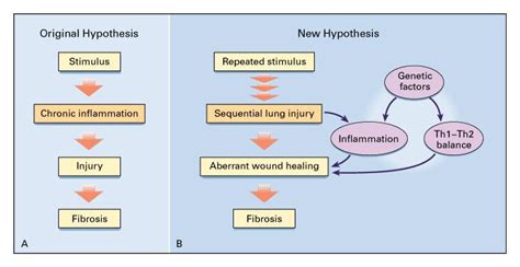 Idiopathic Pulmonary Fibrosis Pathogenesis