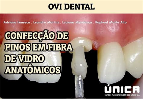 PINOS DENTÁRIOS Confecção de pinos em fibra de vidro anatômicos