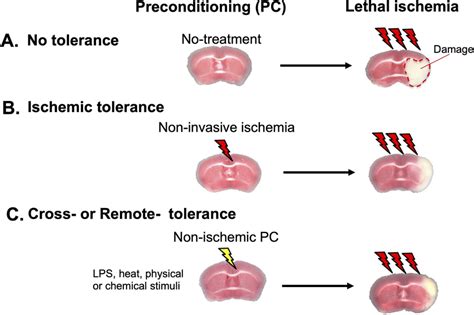 Ischemic Tolerance A Brain Tissues Exposed To Invasive Ischemia Download Scientific Diagram