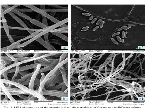 Figure 1 From Scanning Electron Microscopy Of Strawberry Root Rot Pestalotiops Photiniae C16 4