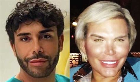 Giacomo Urtis E L Ex Fidanzato Rodrigo Alves Il Ken Umano Che Ha