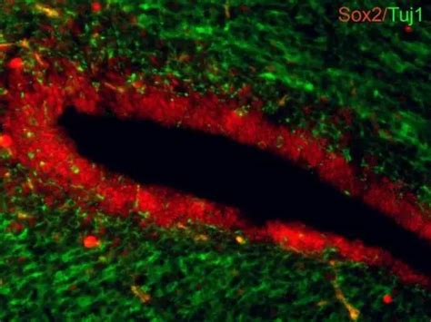 Anti Beta Tubulin 3 Tuj1 Antibody Gt886 Gtx631830 Genetex
