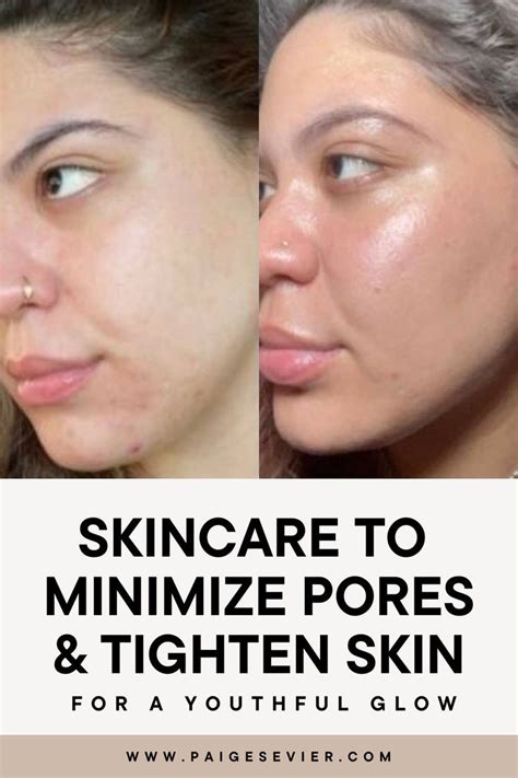Minimize Your Pores With This Easy Regimen… Minimize Pores Skin Care