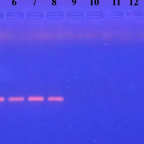 1 5 Agarose Gel Electrophoresis Of Nested PCR Products That Detected