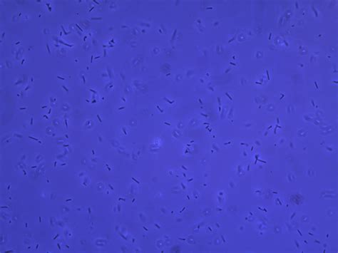 Halobacterium