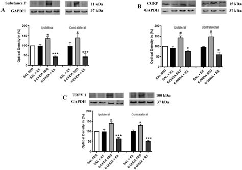 Sp Cgrp And Trpv1 Expression In The Caudal Spinal Trigeminal Nucleus Download Scientific