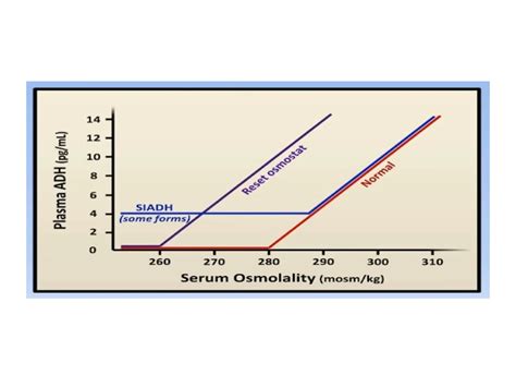 Approach To Hyponatremia Causes Investigation Pathophysiology