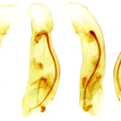Median Lobe Of Male Genitalia Right Lateral Ventral Left Lateral