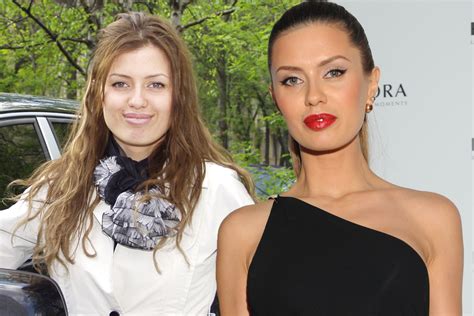 Виктория Боня До И После Пластики Фото 61 Фотo