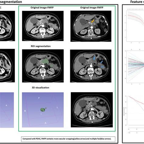 Univariable Logistic Regression Analysis Of Clinical And Cmr Variables Download Scientific