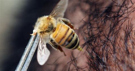 Why Do Bees Die After Stinging