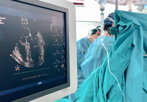 Prosedur Transesophageal Echocardiogram Tee