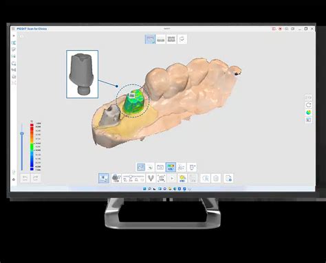 Medit Scan For Clinics Medit Intraoral Scanner And Dental Software