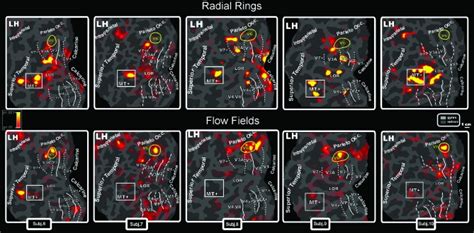 Topography Of Motion Selective Activity By Fmri Mapping From Radial Download Scientific Diagram