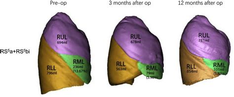 We Use The Volume Of The Residual Rml To Reflect The Function Of Rml
