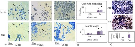 神经酰胺释放具有特定 Mirna 特征的外泌体，用于细胞分化 Scientific Reports X Mol