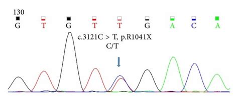Sangers Sequencing Results Of The Spg11 Nm0251373 Variants
