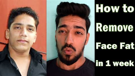How To Remove Face Fat In 1 Week Men And Women 4 Easy Tips Youtube