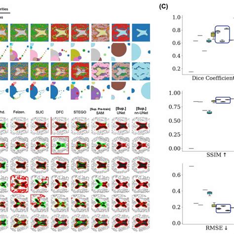 Segmenting Ventricles In Brain MRI Images A Multigranular