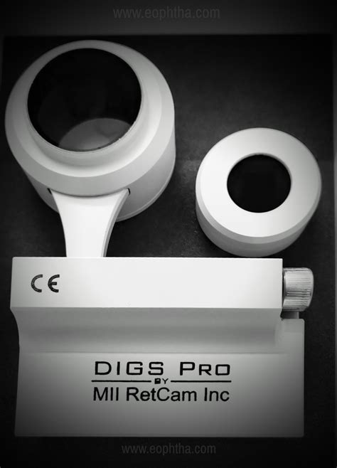 Smartphone Gonio Imaging The Truly Frugal Indian Revolution