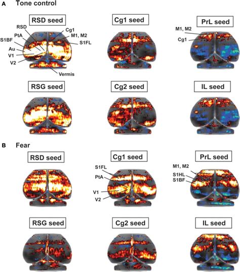 Functional Connectivity Of The Cortical Midline Structures Cms With