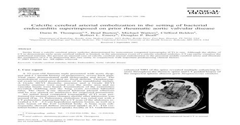 Calcific Cerebral Arterial Embolization In The Setting Of Bacterial
