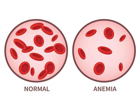 Hemoglobin