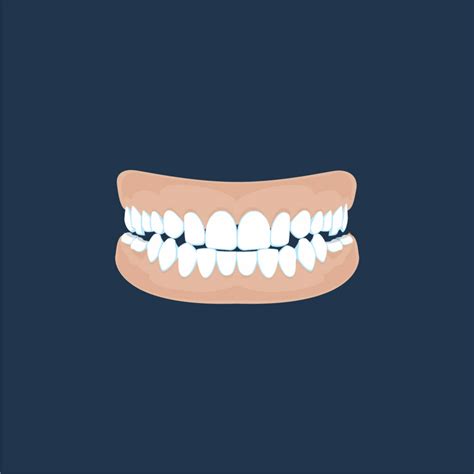 Corinna St Orthodontics Scissor Bite