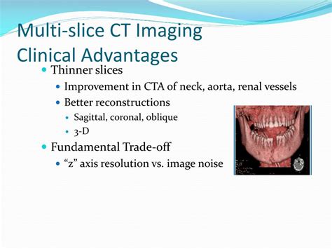 Ppt Multi Slice Ct Powerpoint Presentation Free Download Id 5573730