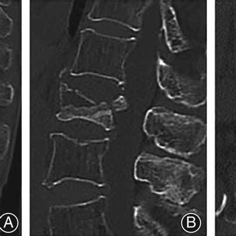 Demonstration Of Different Shapes Of Ivc A Linear Type Ivc Is Download Scientific Diagram