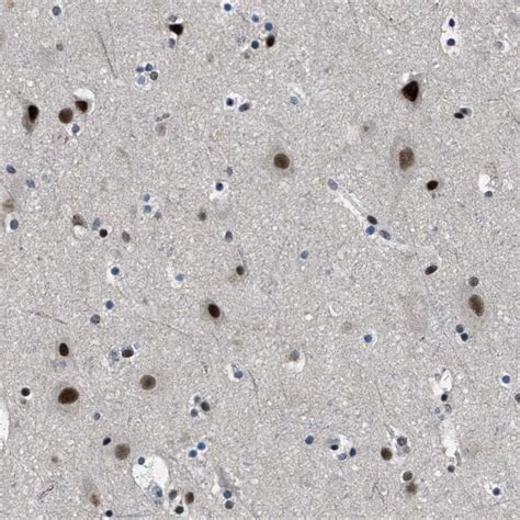 Snf5 Antibody Bsa Free Nbp1 90014 By Novus Part Of Bio Techne