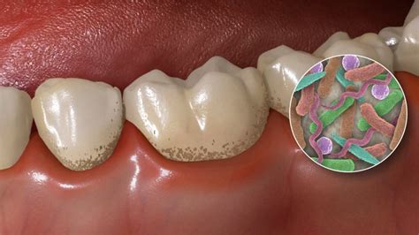 10 Facts You Never Knew About The Human Mouth