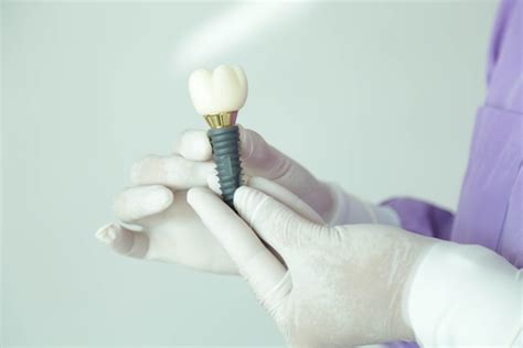 How To Extend The Life Of Your Implant Crown Nw Dental Houston Texas