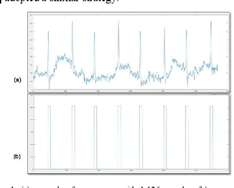 Figure 1 From Semantic Segmentation Of Qrs Complex In 12 Lead Ecg Signals Semantic Scholar