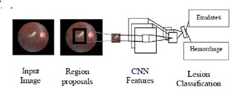 Figure From A Novel Deep Learning Based Method For Retinal Lesion Detection Semantic Scholar