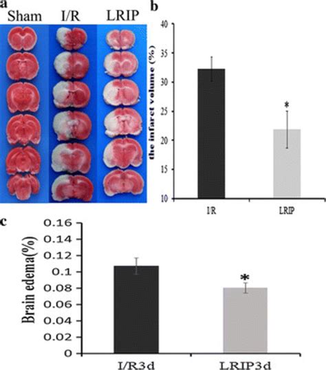 Measurement Of Infarct Volume And Edema Formation At 3 Days Reperfusion Download Scientific