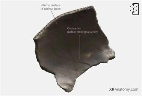 Parietal Bone Interactive 3d Anatomy Surfaces Angles And Sutures Free