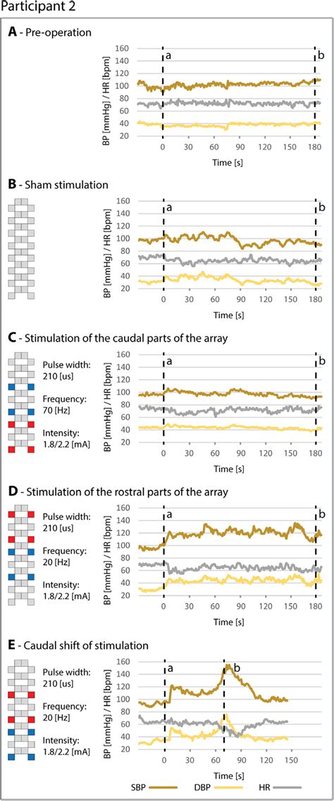 Effect Of Escs On Ejaculatory Response During PVs In Participant 2 A Download Scientific