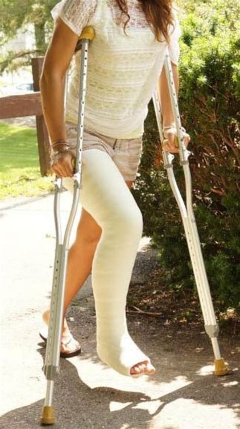 My Experience Wearing A Bent Knee Cast HubPages