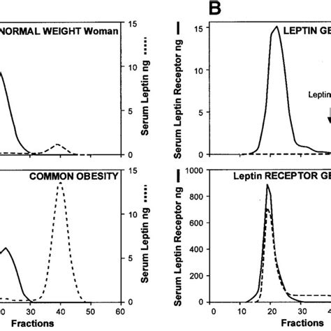 Typical Patterns Of Serum Leptin Receptor And Leptin Levels In
