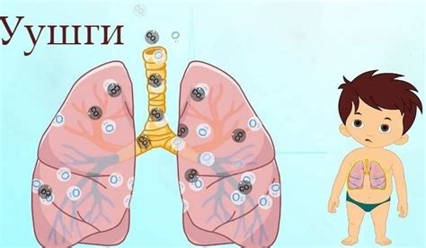 Хатгалгаа өвчний шинж тэмдгийг таних урьдчилан сэргийлэх аргууд