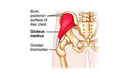 The Mighty Gluteus Medius Sydney Pelvic Clinic Bondi Junction