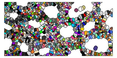 16 Workflow Visium Hd Segmented Orchestrating Spatial Transcriptomics Analysis With