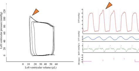 A Pacing Controlled Procedure For The Assessment Of Heart Rate